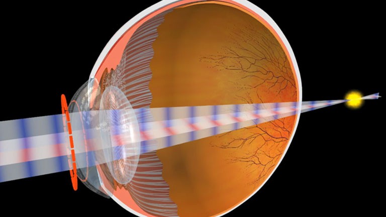 Harbor View Eye Care || Astigmatism